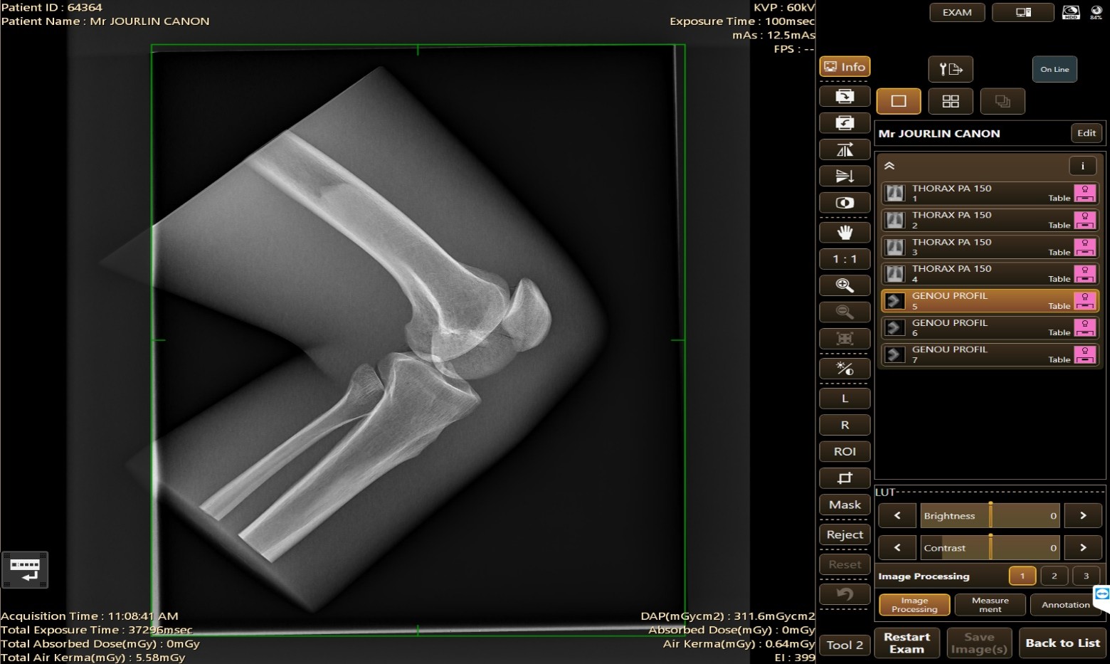Canon DR: Summit Industries X-Ray Equipment
